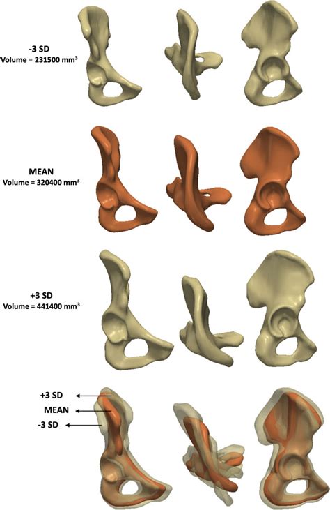 Frontiers Computational Modelling Of Acetabular Morphology And Its