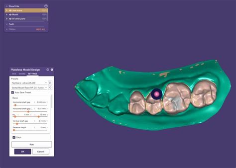 Heygears On Linkedin Heygears Exocad 3shape Digitaldentistry 3dprinting