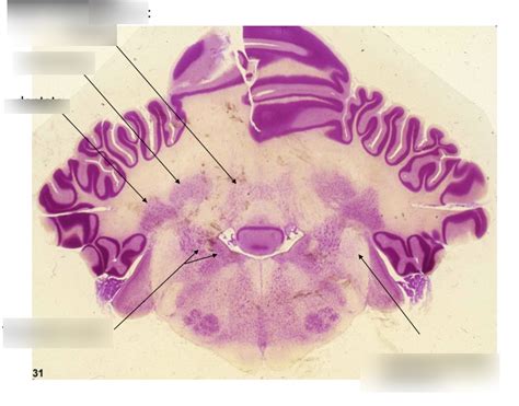 Deep Cerebellar Nuclei Diagram Quizlet