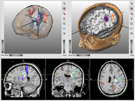 Mevislab Screenshots