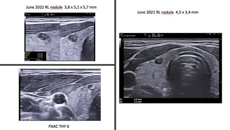 Saveyourthyroid Save Your Thyroid