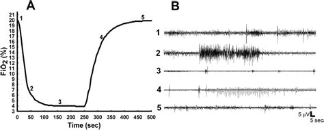 Effects Of Hypoxia On Eeg Characteristics In The P7 8 Mouse Download