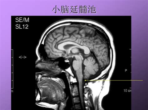 陕西中医学院医学技术系 医学影像教研室 冯璟 ppt download
