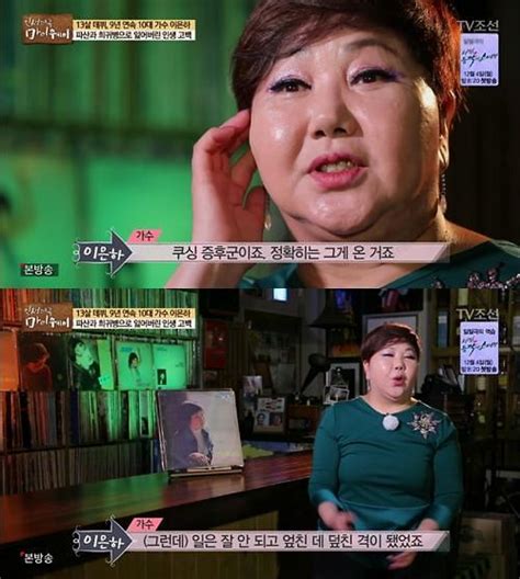 이은하 괴롭히는 쿠싱증후군 무엇 보톡스 맞았냐 오해받을 정도 아주경제