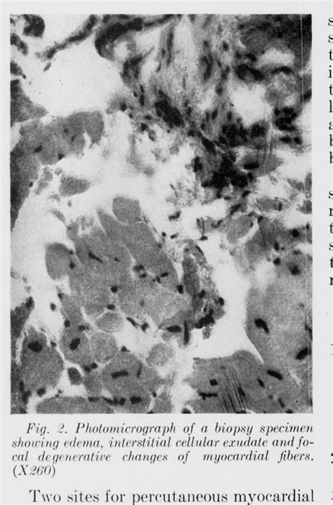 Figure 2 From Needle Biopsy Of The Human Ventricular Myocardium Semantic Scholar