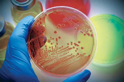 Bacterial Transformation The Transforming Principle 1 Microbiology