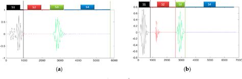 figure 1 from classification of heart sound signal using multiple