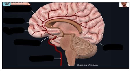 Diagram Of Anterior Cerebral Artery Branches Quizlet
