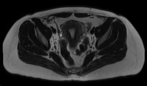 Ct Pelvis Diagram Quizlet