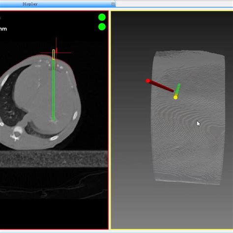 A Screenshot Of The Visualization Interface Of The Kinect Optical Download Scientific Diagram