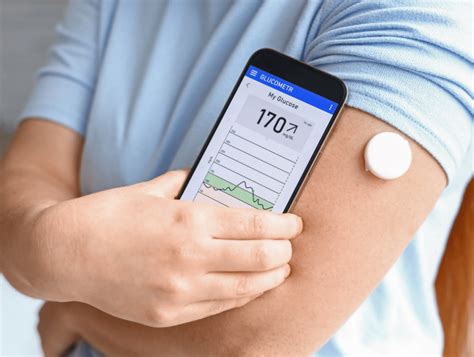 Continuous Glucose Monitoring Sri Nagesh Clinic