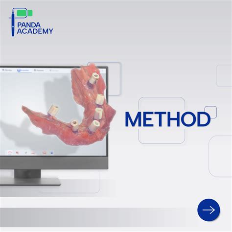 Panda Academy How To Scan The Scanbody