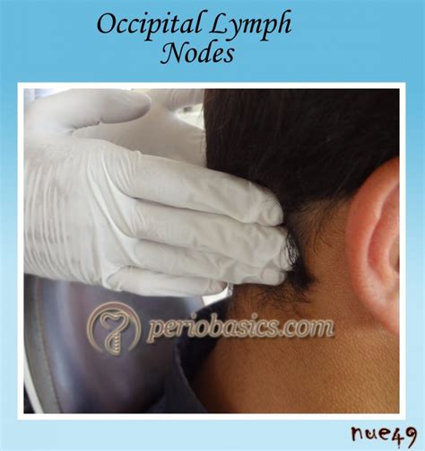 Occipital Lymph Nodes Matvikol