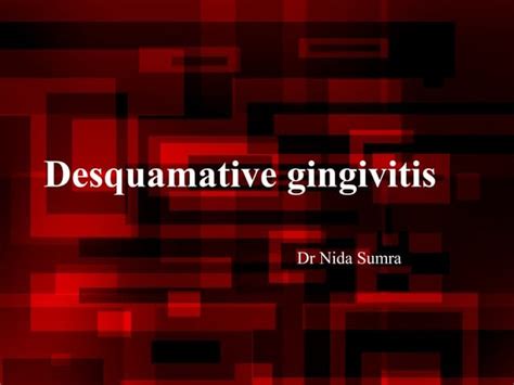 Necrotizing Ulcerative Gingivitis Pptx Dental Health Diseases And Conditions