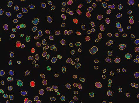 2d Automated Analysis Image Pro Media Cybernetics