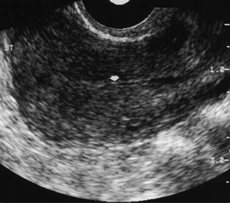 Pelvic Quiz 2 Flashcards Quizlet