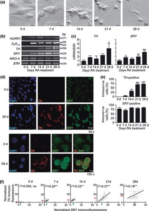 Expression Analysis Of Sex Determining Region On The Y Chromosome Sry