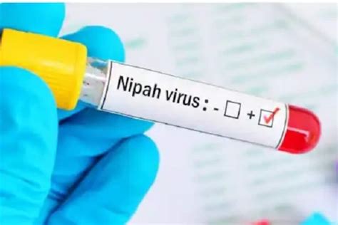 കോഴിക്കോട് ഒരാൾക്ക് കൂടി നിപ സ്വകാര്യ ആശുപത്രിയിലെ ആരോ ഗ്യപ്രവർത്തകന് രോ ഗം സ്ഥിരീകരിച്ചു One