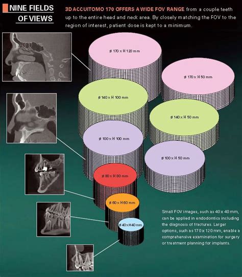 Confusion To Clarity The Perfect Cbct 10 Steps To Making The Right Choice
