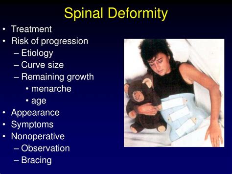 Ppt Spinal Deformity And Degeneration Powerpoint Presentation Free