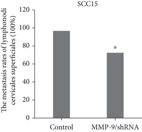 Mmp 9 Knockdown Inhibits Oscc Cell Metastasis To Lymphonodi Cervicales