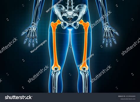 Femur Thigh Bone Xray Front Anterior Stock Illustration 2219926069