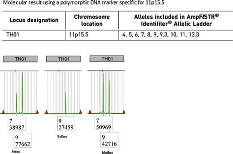 Quantitative Fluorescenceepolymerase Chain Reaction Short Tandem Repeat