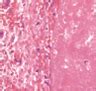 Pathology Lab Quiz Flashcards Quizlet