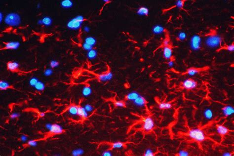 5 Tips To Reduce Autofluorescence