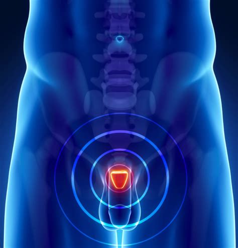 Darolutamide Shows Acceptable Long Term Safety Profile In Nonmetastatic