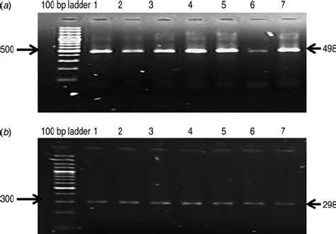 Agarose Gel Electrophoresis Showing Pcr Ampli Fi Cation Products A