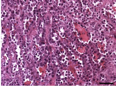 Embryonal Carcinoma Cells