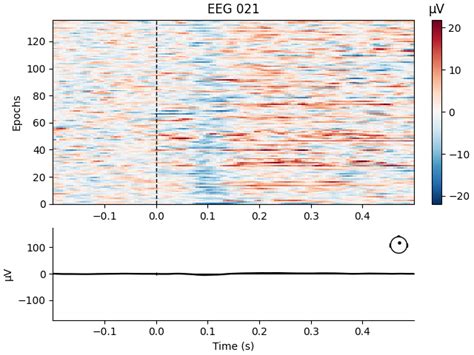 Overview Of Megeeg Analysis With Mne Python — Mne 1110dev85
