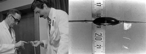 3 Andreas Grüntzig Jubiläums Symposium 45 Jahre Koronarangioplastie