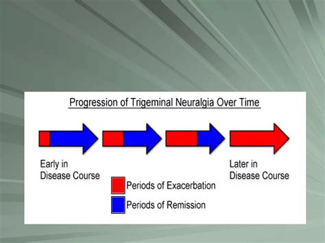 Trigeminal Neuralgia Pptx