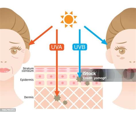 Uva と Uvb レイの違いを示すインフォグラフィック図 人間のスキンケアと美容コンセプトへのuv浸透 皮膚のベクターアート素材や画像を