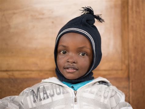 Success David From Kenya Raised 1224 To Fund Clubfoot Correction
