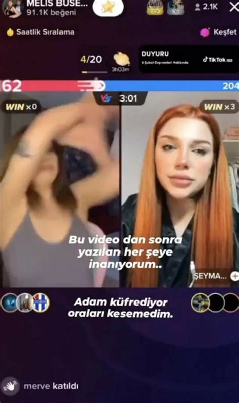 Melis Buse Betkayan evli sevgilisi tarafından şiddet gördü Magazin