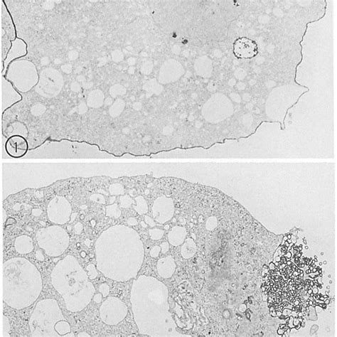 Polar Accumulation Of Con A Receptors Cap Formation In An Amoeba Download Scientific Diagram