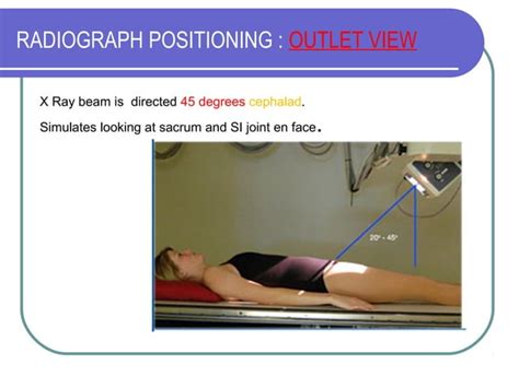 Pelvic Fractures Classification And Management PPT