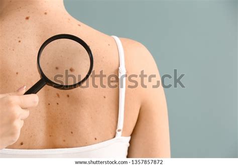 Skin Examination Images Stock Photos Vectors Shutterstock