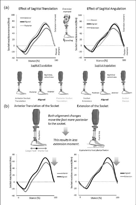 Figure 2 From Dynamic Alignment Of Transtibial Prostheses Through