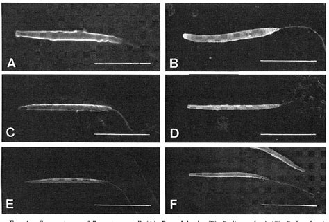 Figure 1 From Sperm Morphology Of Some Indian Frogs As Revealed By Sem