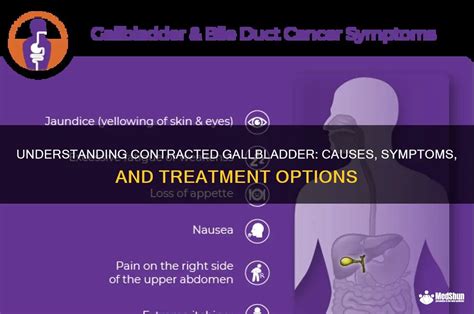 Understanding Contracted Gallbladder Causes Symptoms And Treatment