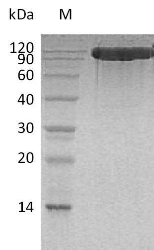 Recombinant Human Angiotensin Converting Enzyme 2 Ace2 Partial Active