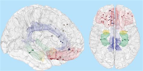 Researchers Decode Mood From Human Brain Signals USC Viterbi Babe