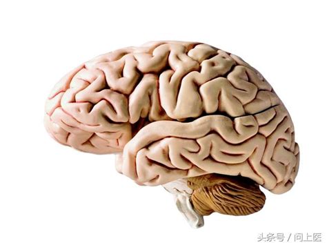 腦幹中風你知道多少 每日頭條