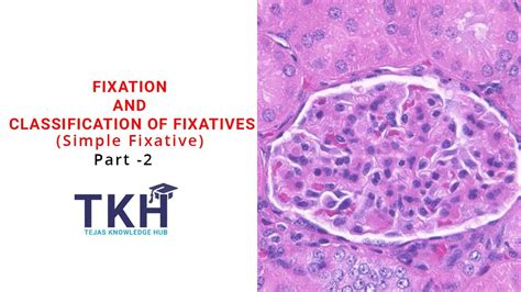 Difference Between Fixation And Fixative At Lucy Via Blog