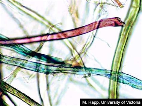 Microplastics And Health Risks What Do We Really Know