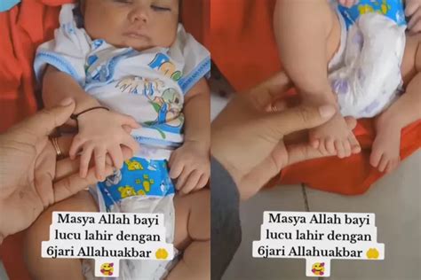 Viral Bayi Perempuan Di Sampang Madura Lahir Dengan 24 Jari Di Tangan Dan Kakinya Indozone Life